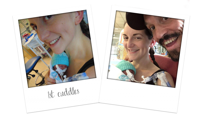 Prader Willi Syndrome Baby Milestones - Life in Focus Portraits